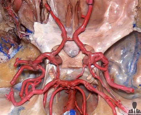 Blastomédico Polígono De Willis El Polígono De Willis