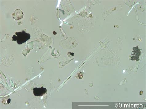 House Dust Under Microscope At Scarlett Foy Blog
