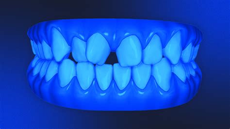 Premium Clinical Deep Dive — 9 Class I Premium Clinical Deep Dive — 9 Class I