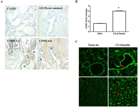 ccn1 expression and secretion after cigarette smoking cs and