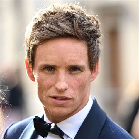 Eddie Redmayne Freckles