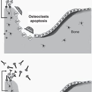Pdf Treatment Options For Osteogenesis Imperfecta