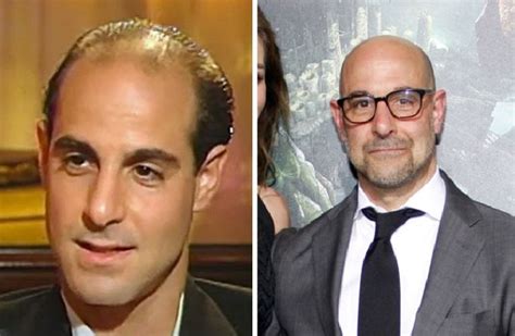 41 Famous Bald Celebrities Estepera Hair Clinic