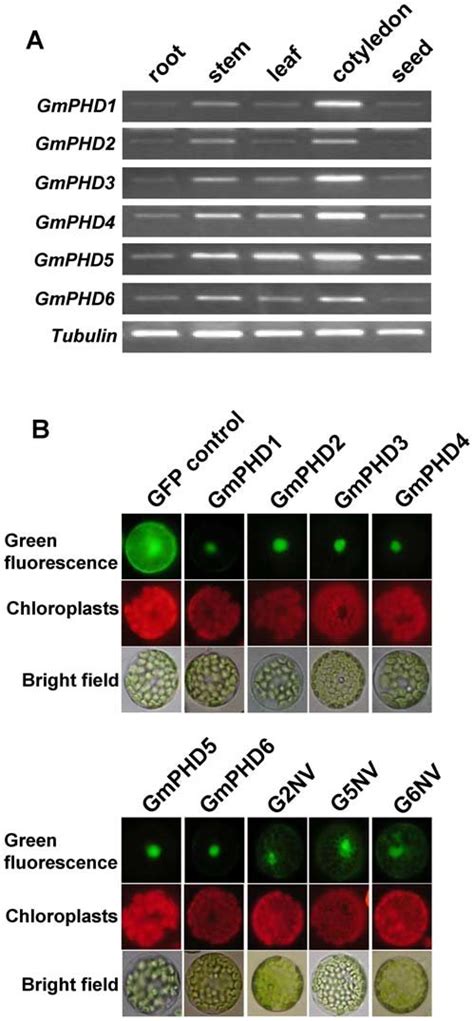 Organ Specific Expression And Subcellular Localization Of The Gmphds