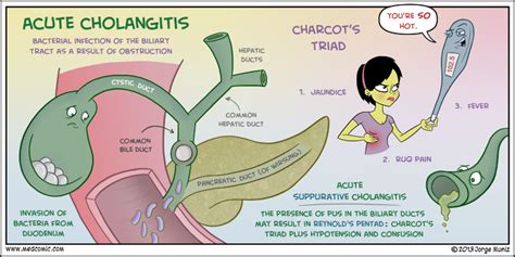 cholangitis meaning bile duct diseases harvard health