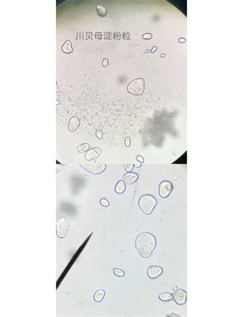 川贝母与浙贝母的显微特征对比