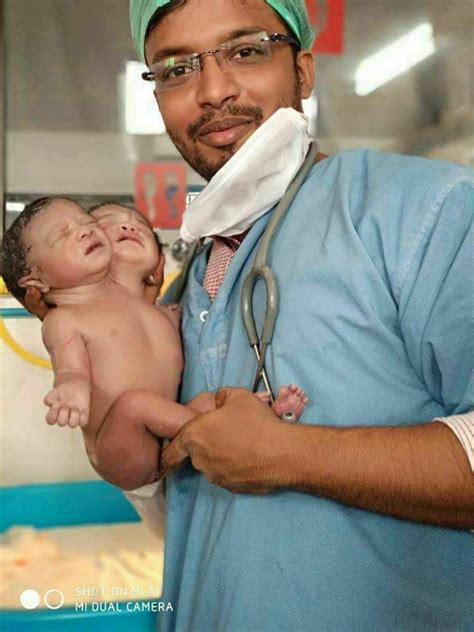 Birth Defects Two Heads