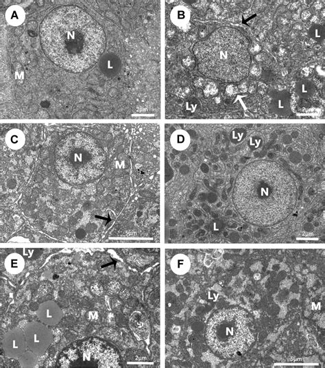 Frontiers The Protective Roles Of Dietary Selenium Yeast And Tea