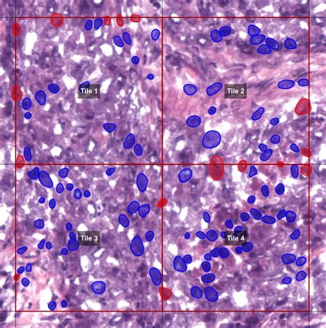 the annotations on the border cannot be inserted in hierarchy usage and issues image sc forum