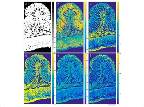 Maps Of Raman Spectral Similarity In Paraffin Fixed Colonic Tissue Download Scientific Diagram