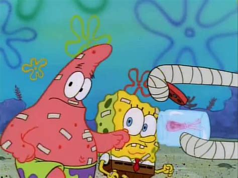 Spongebob Lips Sting