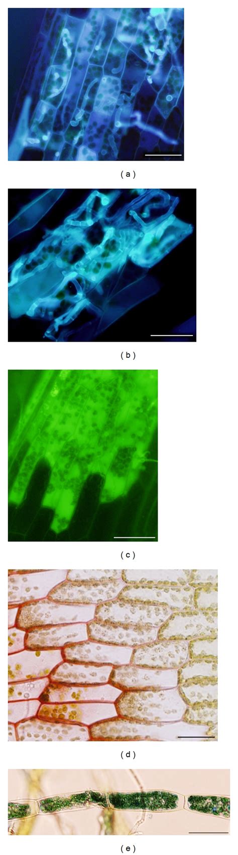 Pathogen Growth And P Patens Responses P Irregulare Infected Leaf