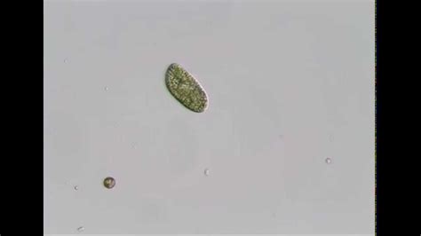 Ciliates Under Microscope