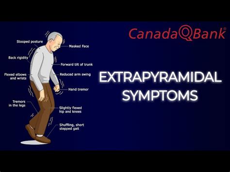 Extrapyramidal Symptoms Chart Antipsychotic Induced Extrapyramidal