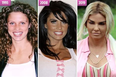 Katie Prices Life Story 25 Years Of Plastic Surgery