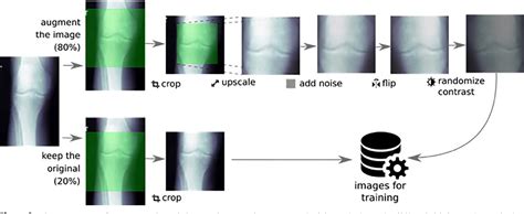 Figure 1 From Automated Classification Of Radiographic Knee