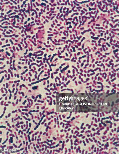 Diplococcus Color Photos And Premium High Res Pictures Getty Images
