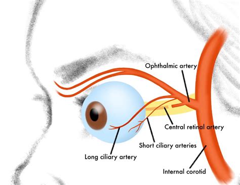 Ophthalmic Artery Traumatic Intracranial Internal Carotid Artery