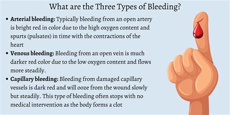Types Of Bleeding Gastrointestinal Gi Bleeds Types Of Bleeds