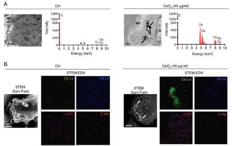 Edx And Stem Analysis Of Cerium Dioxide Nanoparticles Inside Cells Vct