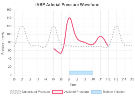 Iabp Machine Explained Working Uses Parts And Price In 2025