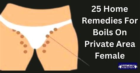How To Treat A Boil On Your Buttocks 3 Simple Steps Best Treatment For Boils On Your Buttocks