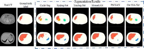 Figure 1 From Attention Based Cross Domain Synthesis And Segmentation From Unpaired Medical