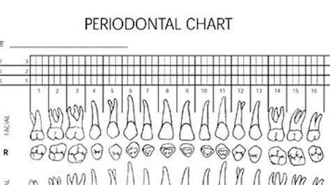 Perio Charting Form Printable