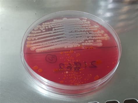 Enterobacter Aerogenes On Macconkey Agar