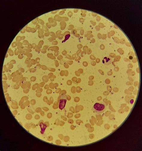 Leishmania Spp Mikrobiyoloji