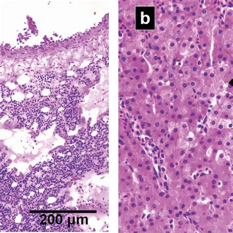 Phylogeny Of Ctx M 8 Producing Escherichia Coli Isolate From A Download Scientific Diagram