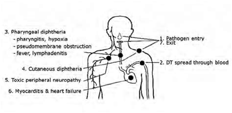 Pathogenesis Of The Diphtheria Disease The Illustration Summarizes Download Scientific Diagram