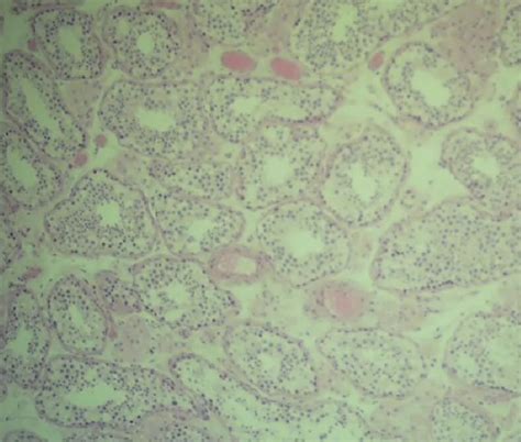 Testis Slide Diagram Quizlet