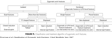 A New Proposal Of Classification Of Zygomatic Arch Fractures