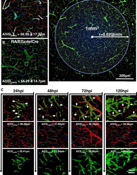 Quantification Of Brain Microvascular Network Density A Microvessels