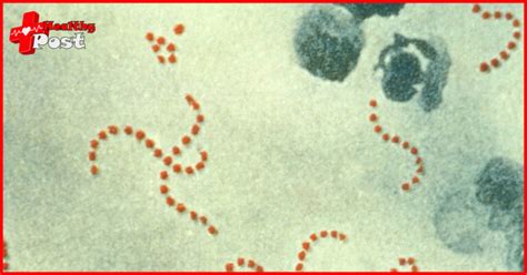 What Do You Know About Cocci Streptococcus Spp