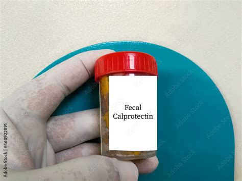 Doctor Holding Stool Specimen Jar For Faecal Calprotectin Test To Diagnosis Inflammatory Bowel