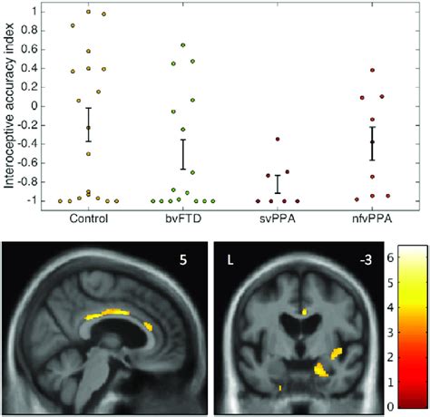 interoceptive accuracy in participant groups behavioral and