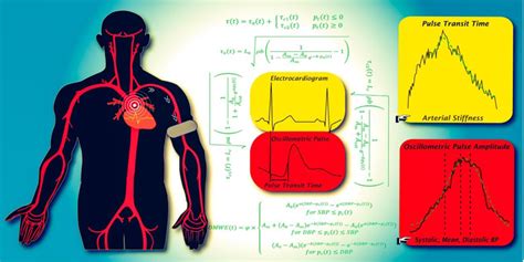 Sensor Informatics Embs
