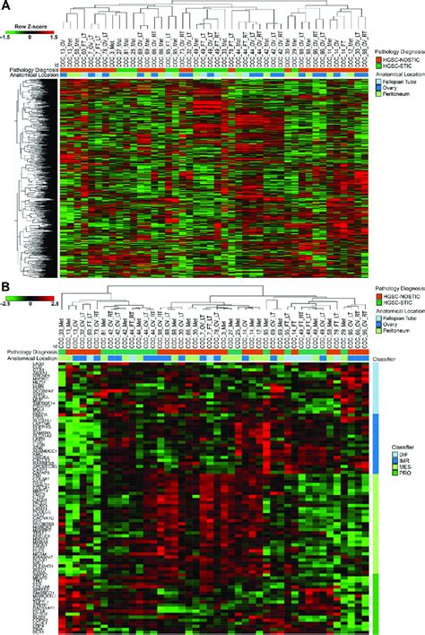 unsupervised and supervised hierarchical clustering of hgsc tumor