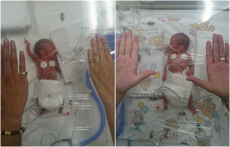24 Weeks Ultrasound Twins