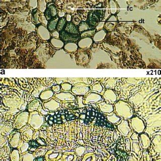 Partial View Of The Mesophyll With A Resin Duct A Abies Alba B A