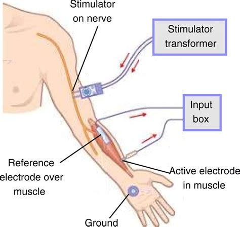 Recording Emg Signals Using Electrodes Attached On The Muscle Surface [19] Download Scientific