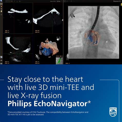 Sandro Stefanelli On Linkedin Discover How Your Heart Team Can Benefit