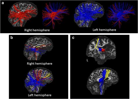 A Thalamocortical Connections In The Right Hemisphere Red