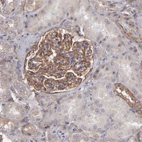 Anti Itgb5 Human Protein Atlas Antibody