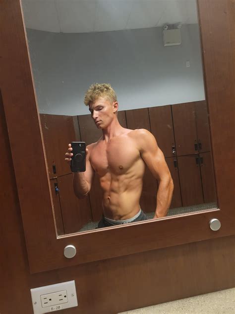 2 Year Pectus Transformation R Pectusexcavatum