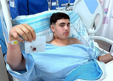 הטיל שנפל בחיפה הנס של איתי מייסון רק של מילימטר אחד חי פֹּה תאגיד החדשות של חיפה והסביבה