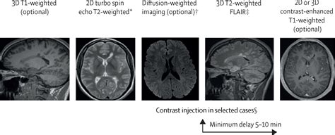 2021 MAGNIMSCMSCNAIMS Consensus Recommendations On The Use Of MRI In