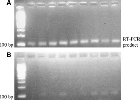Detection Of The 102 Base Pair Product Of Reverse Transcriptase